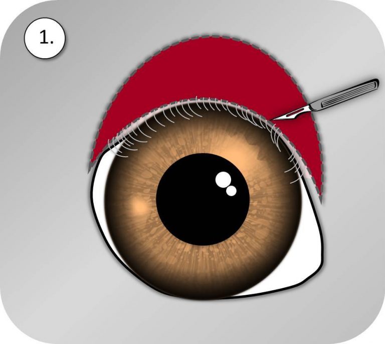 Entropium | Augentierarzt Allgoewer