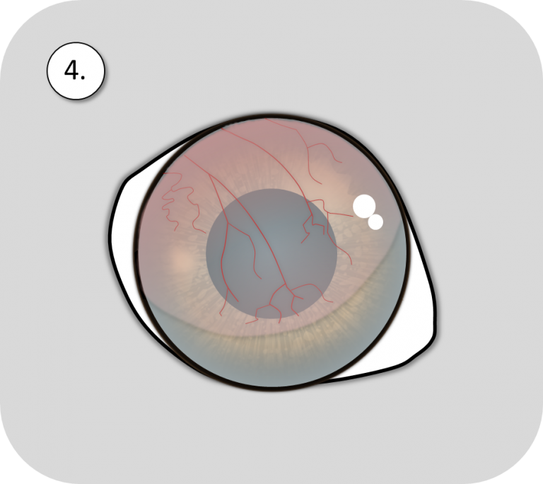 Gundersen – Flap bei Endotheldystrophie | Augentierarzt Allgoewer